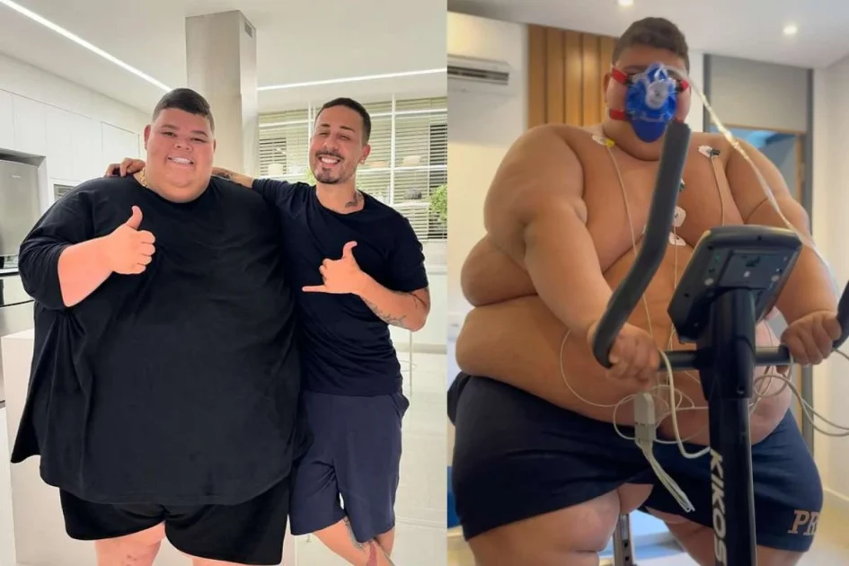 Gordão da XJ, o influenciador de 19 anos que chegou a pesar 339 kg, tem grande perda de peso exposta