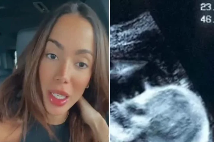 Anitta pega todo mundo de surpresa ao mostrar ultrassom e aparecer com ...