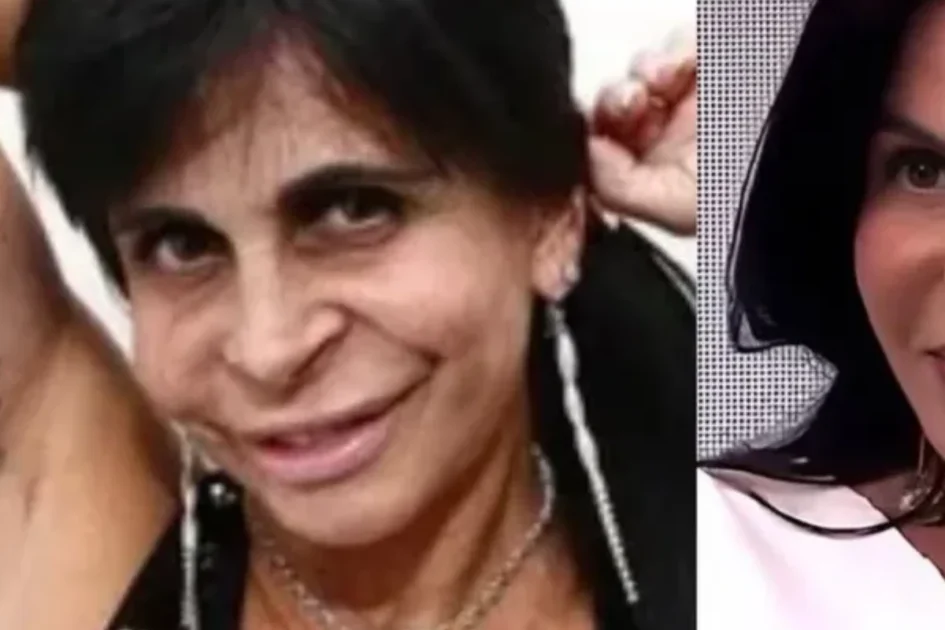 Antes e depois: Gretchen ganha novo rosto e internautas não acreditam ...